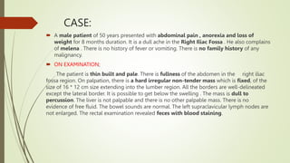 CARCINOMA OF CAECUM and treatment of lower GI cancers.pptx