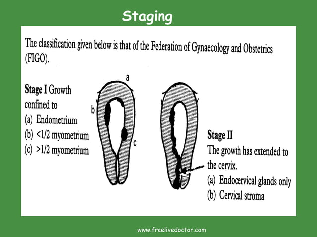 Carcinoma of endometrium | PPT
