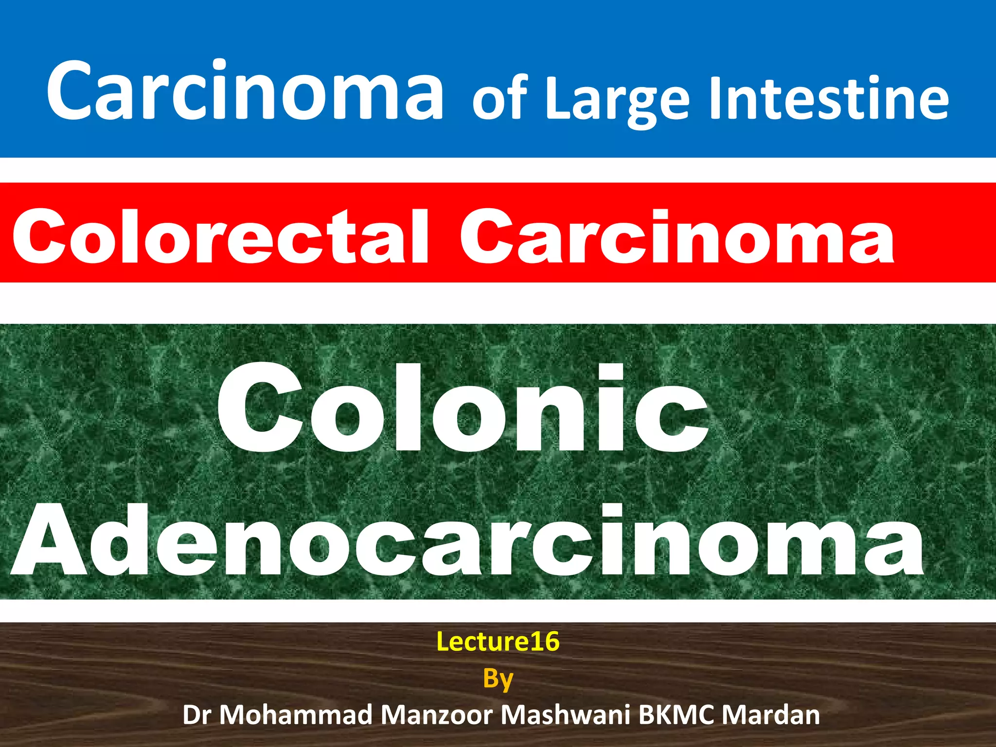 Carcinoma of large intestine, Colorectal Carcinoma (Adenocarcinoma) | PPT
