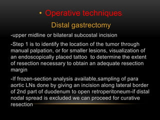 Carcinoma of stomach | PPTX