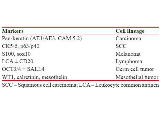 Carcinoma of unknown primary | PPT | Cancer | Diseases and Conditions