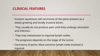 Carcinoma Penis. practical ppt 1234.pptx