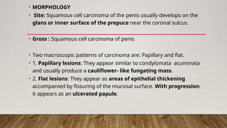 Carcinoma Penis. practical ppt 1234.pptx
