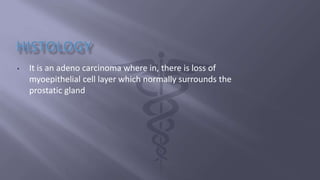 carcinoma prostate - subhash.pptx