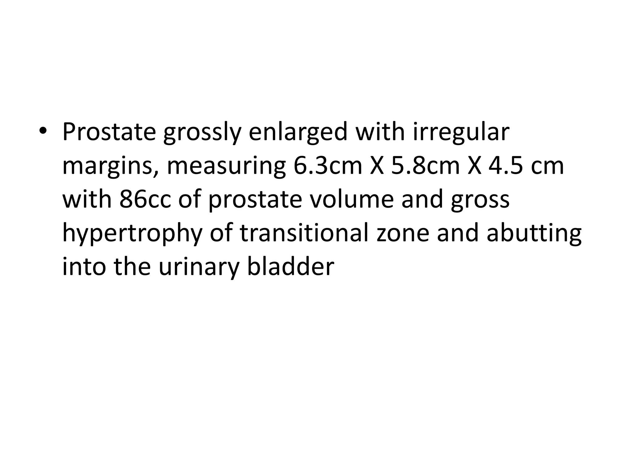 Carcinoma prostate case presentation.pptx