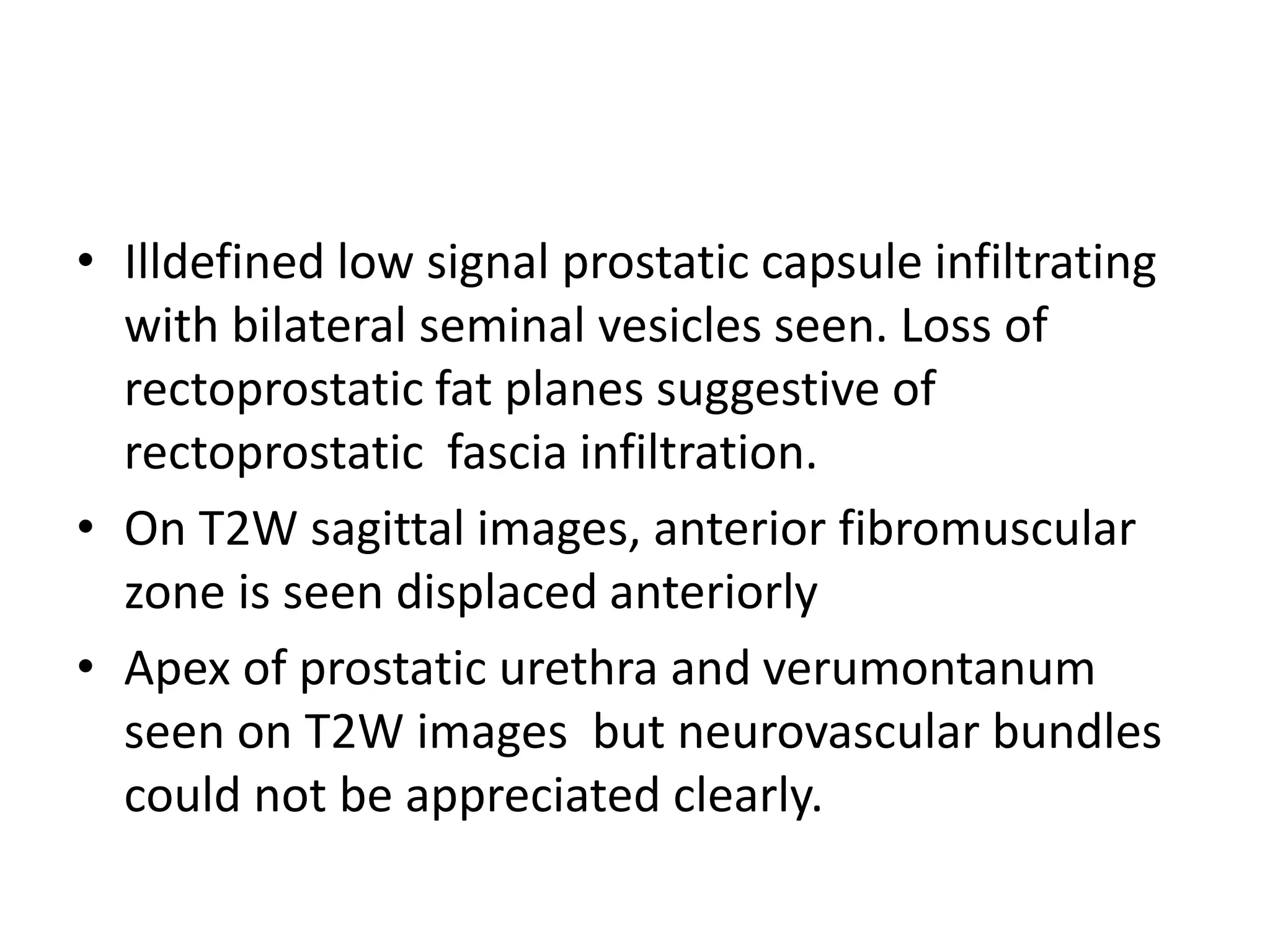 Carcinoma prostate case presentation.pptx