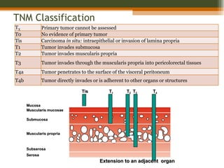Carcinoma rectum (Rectal Cancer) | PPT