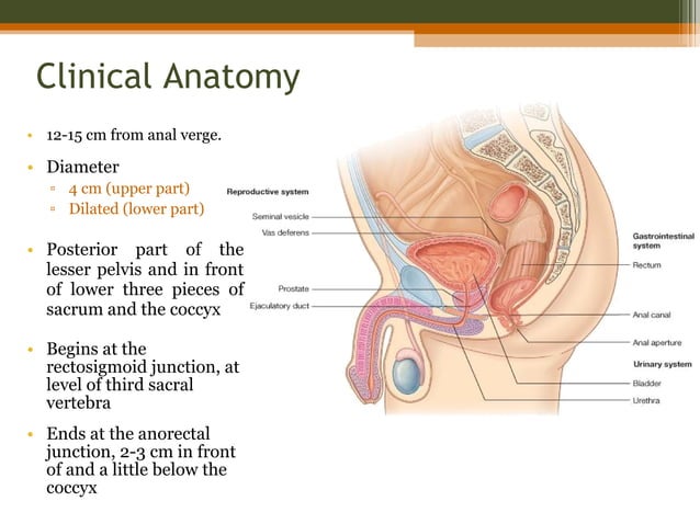 Carcinoma rectum (Rectal Cancer) | PPT