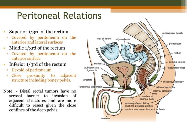 Carcinoma rectum (Rectal Cancer) | PPT