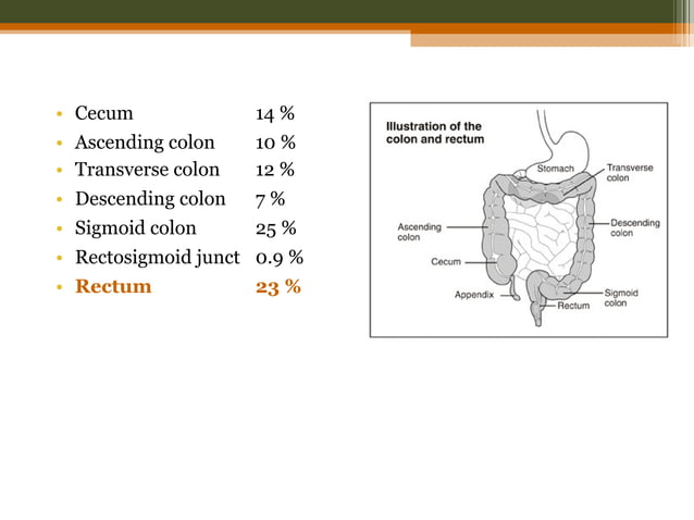 Carcinoma rectum (Rectal Cancer) | PPT