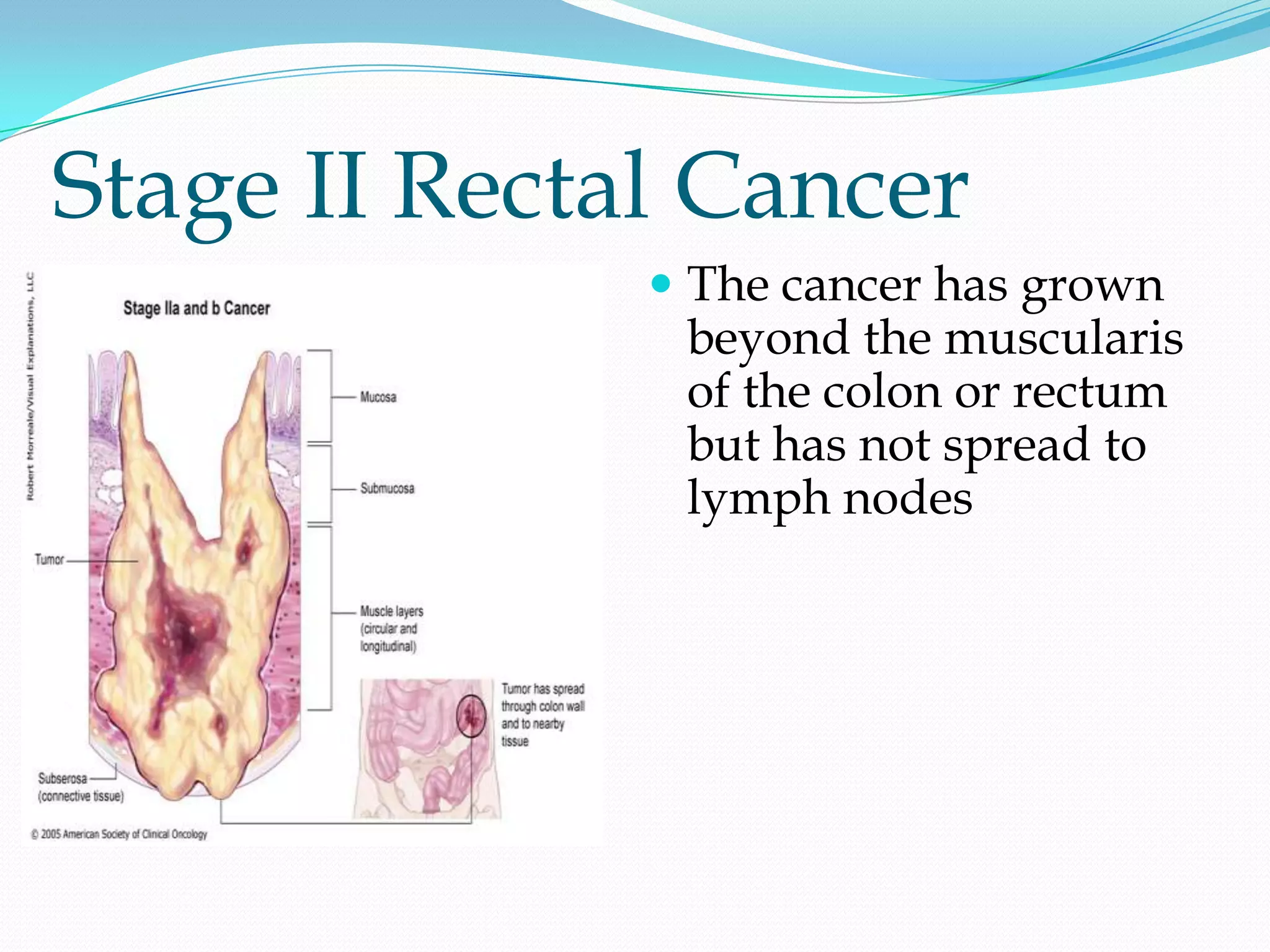 Carcinoma rectum-radiotherapy perspective | PPTX