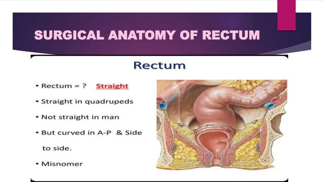 Carcinoma rectum.pptx