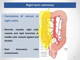 Carcinoma rectum & colon part 2 | PPTX