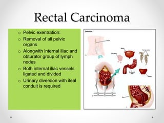 Carcinoma rectum & colon part 2 | PPTX