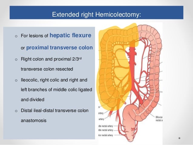 Carcinoma rectum & colon part 2