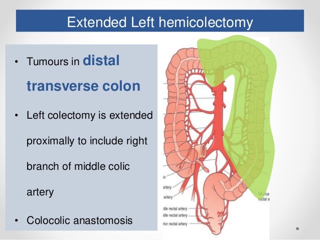 Carcinoma rectum & colon part 2