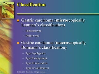 Carcinoma stomach | PPTX