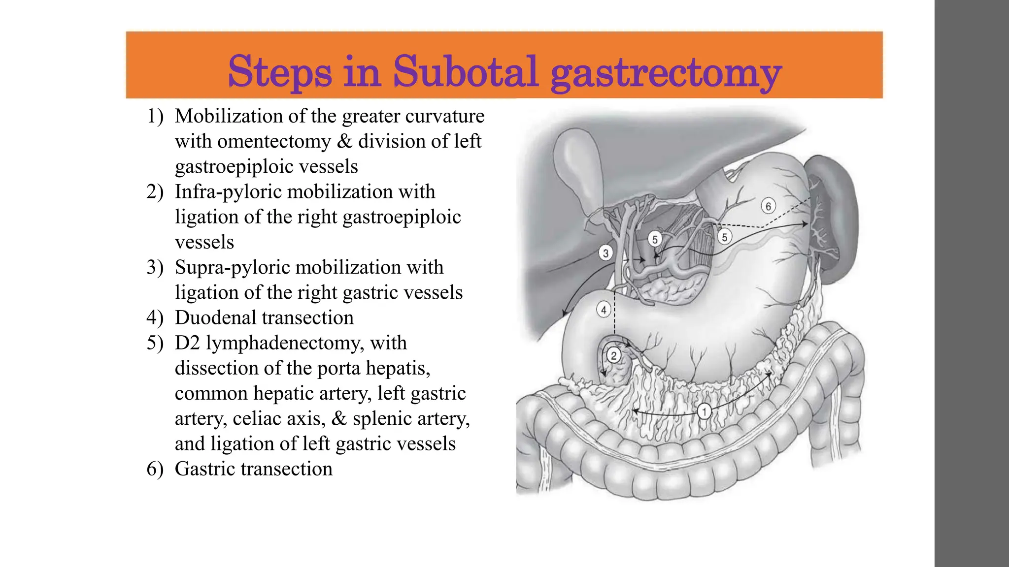 CARCINOMA STOMACH- MANAGEMENT PRINCIPLES | PPTX