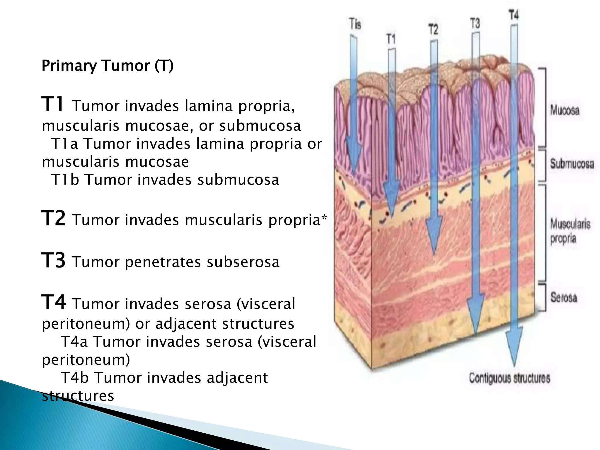 carcinomastomachpresentation-190929082053 (1).pdf