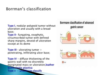 carcinomastomachpresentation-190929082053 (1).pdf