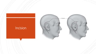 Carcinoma temporal bone | PPTX
