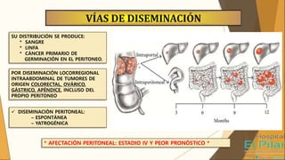 Carcinomatosis peritoneal | PPTX