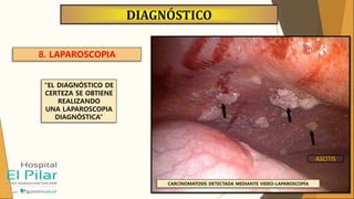 Carcinomatosis Peritoneal PPTX