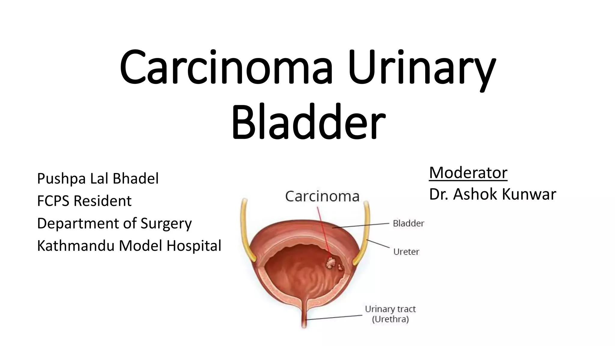 Carcinoma Urinary Bladder.pptx