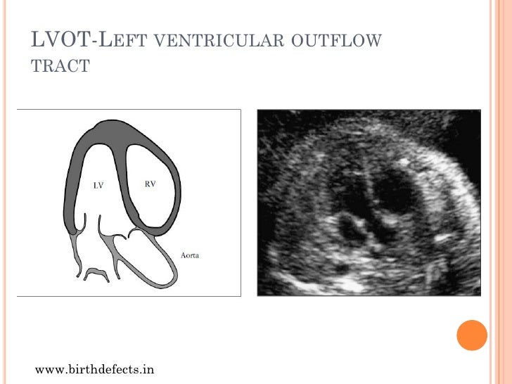 Fetal Cardiac Examination