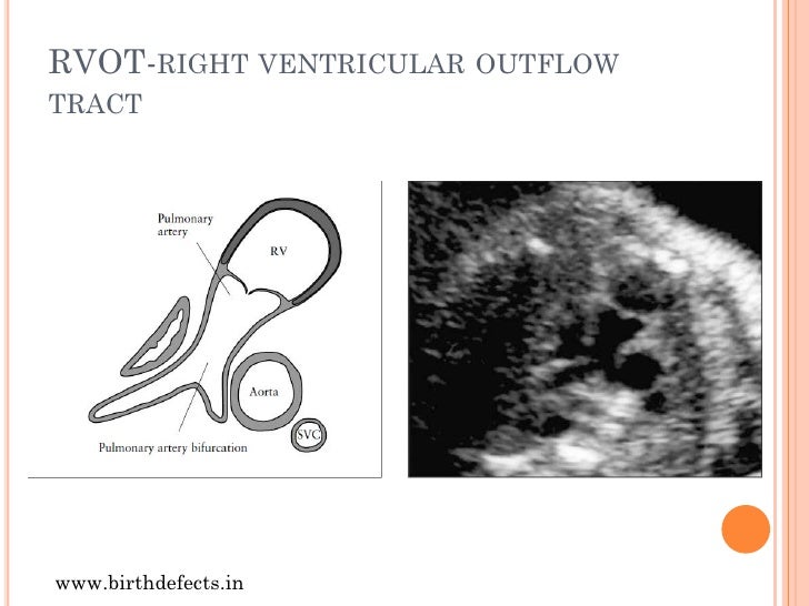 Fetal Cardiac Examination