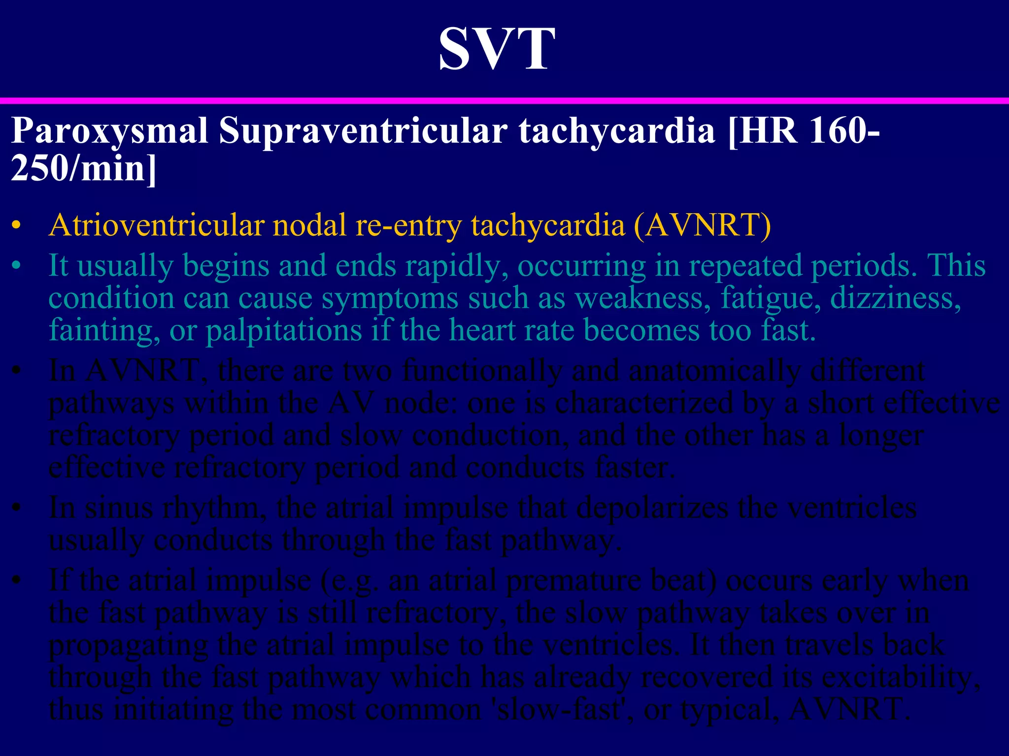Cardiac arrhythmia | PDF