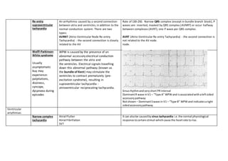 Cardiac Arrythmias | DOCX