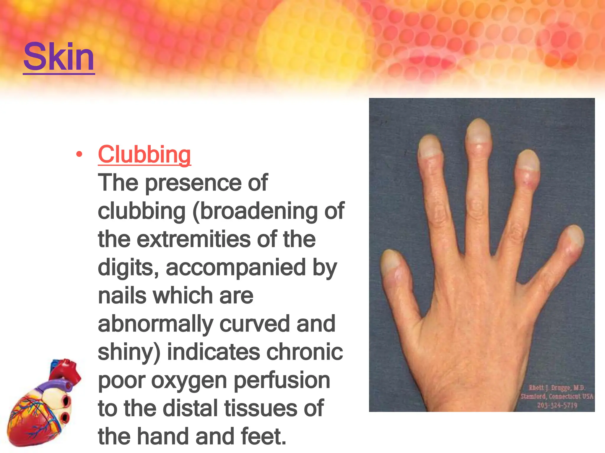 cardiac-assessment- for physiotherapist and respirotory therapist | PPTX