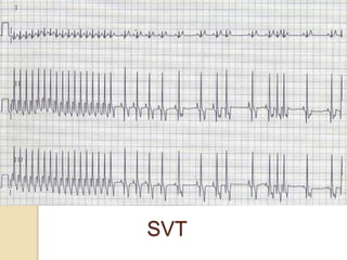 Cardiac function test | PPTX