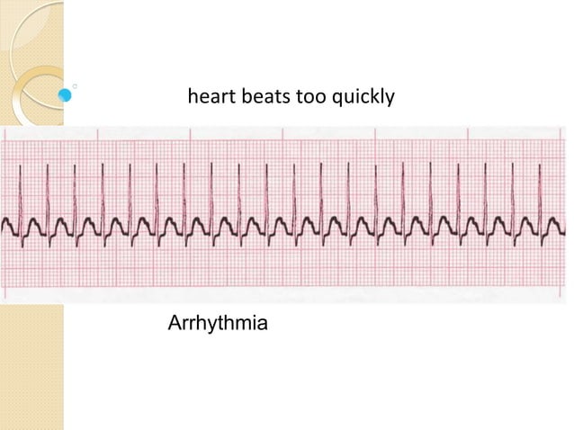 Cardiac function-test | PPTX | Heart and Cardiovascular Diseases ...