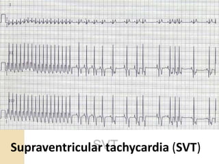 Cardiac function-test | PPTX