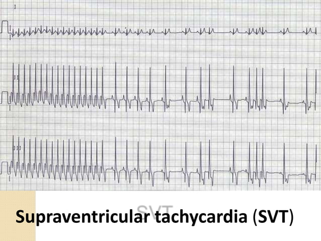 Cardiac function-test | PPTX | Heart and Cardiovascular Diseases ...