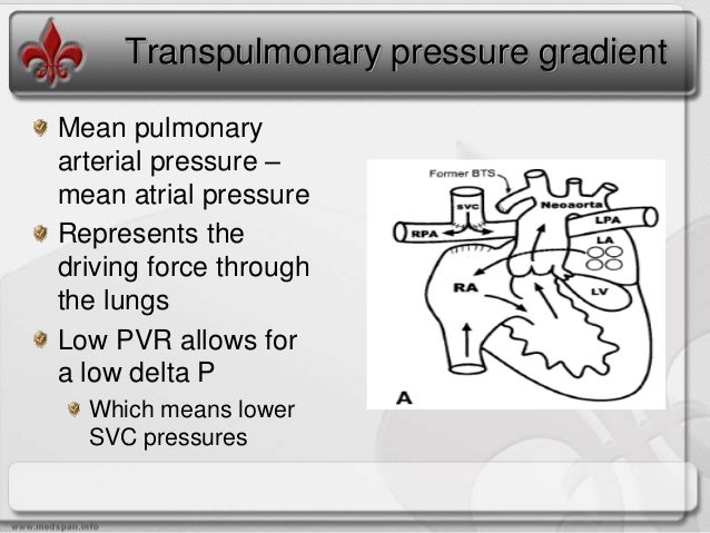 Cardiac single ventricle