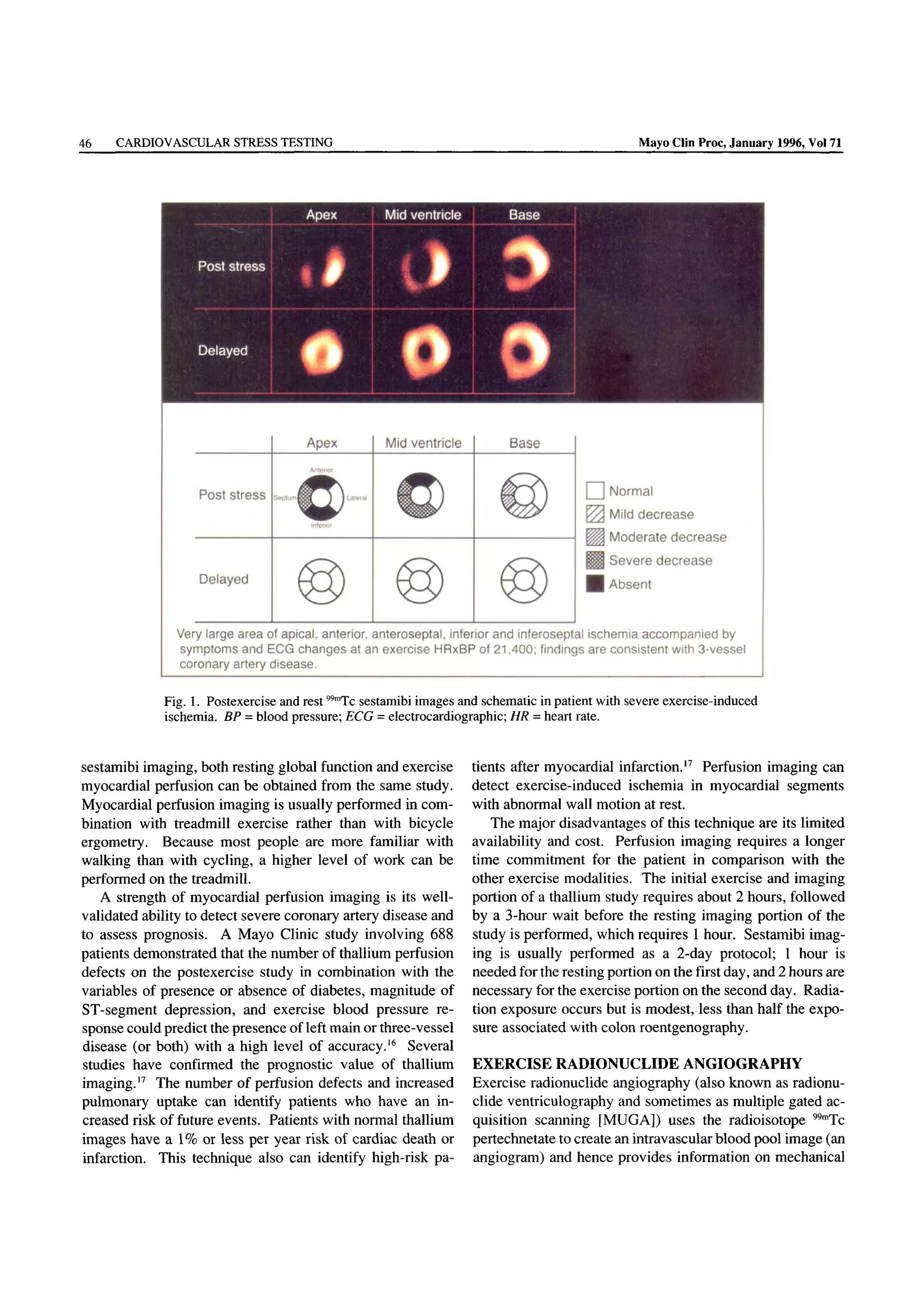 Cardiac Tests Ppt