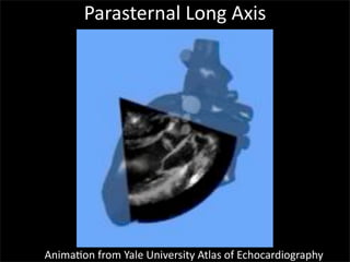 Cardiac ultrasound | PDF