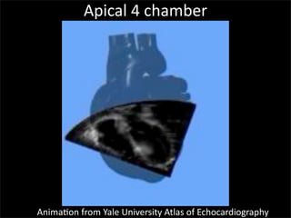 Cardiac ultrasound | PDF