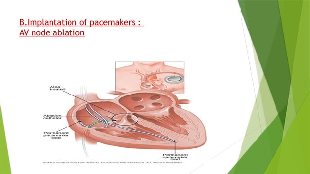 CARDIAC AAREST PRESENTATION .PPT FOR NURSING STUDENT | PPT
