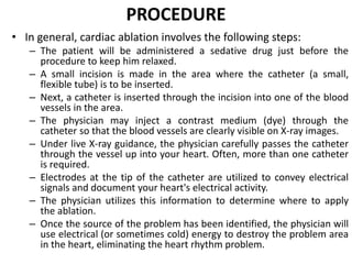 Cardiac Ablation Catheter used in cardiac systems | PPT
