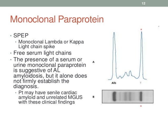 Cardiac amyloidosis