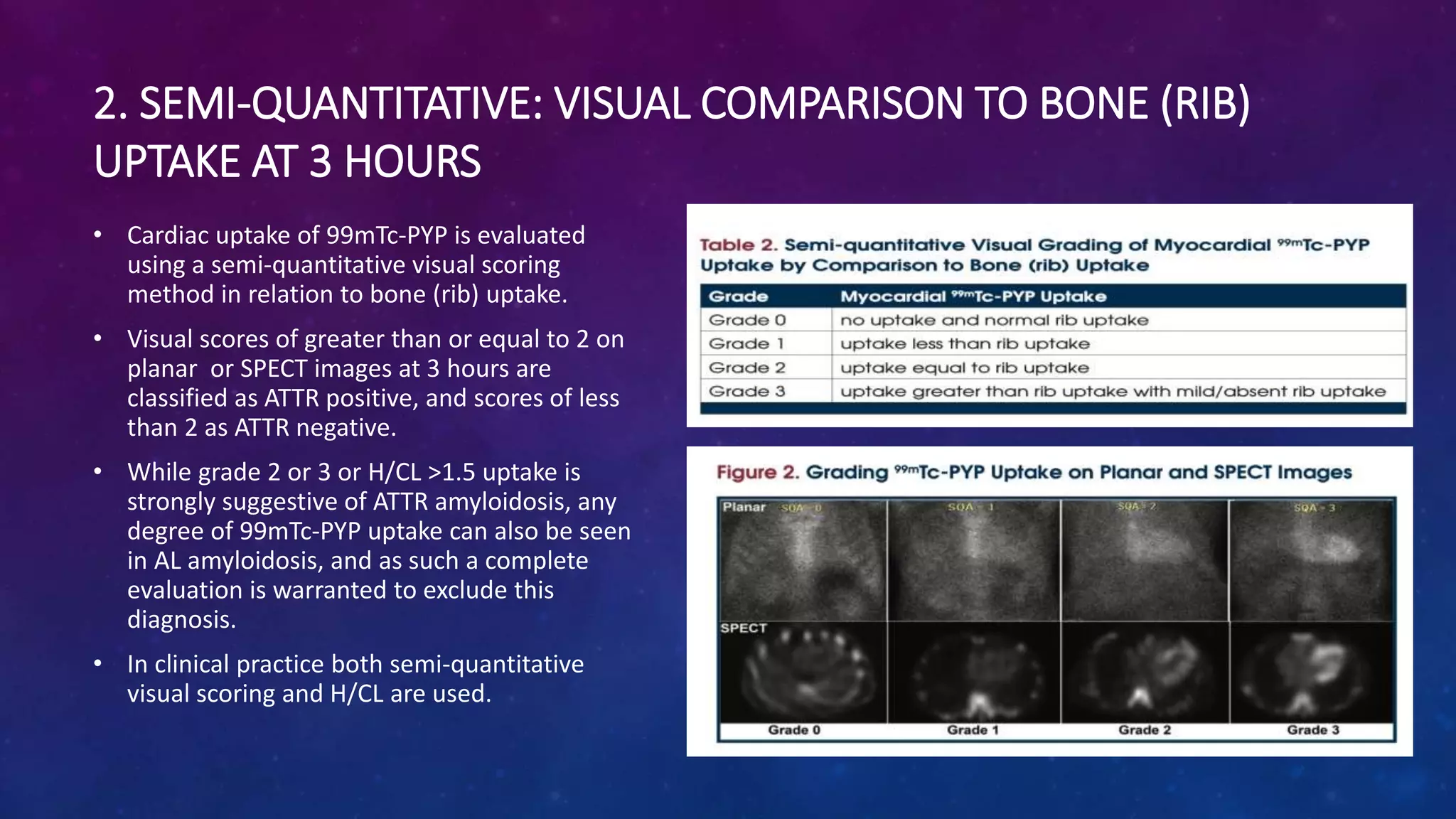 CARDIAC AMYLOIDOSIS | PPTX