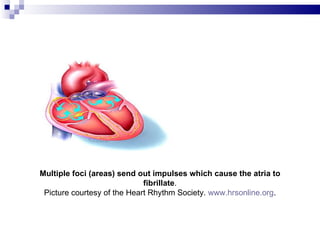 Cardiac Anatomy | PPT