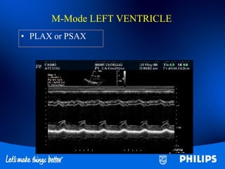 Cardiac anatomy | PPT