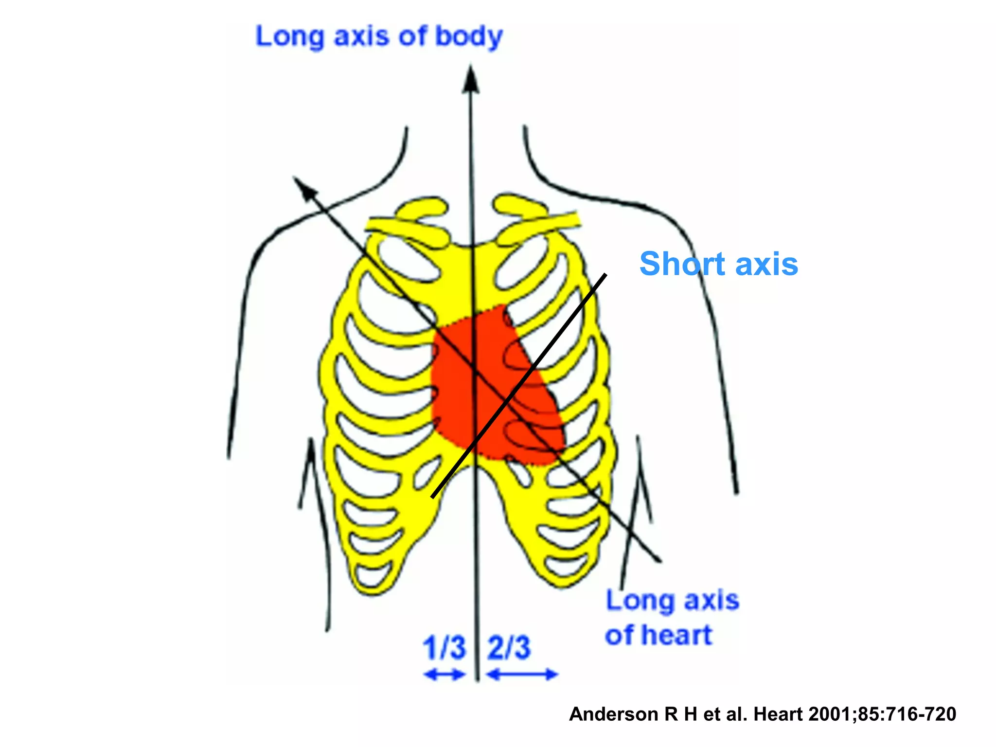 Cardiac Anatomy_20120916_南區 | PPT