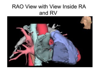 Cardiac Anatomy_20120916_南區 | PPT
