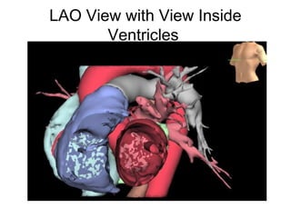 Cardiac Anatomy_20120916_南區 | PPT
